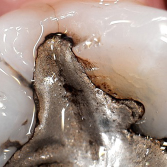 Digital Doc | High Resolution Dental Intraoral Cameras, Hand held Xray