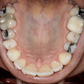 Digital Doc | High Resolution Dental Intraoral Cameras, Hand held Xray