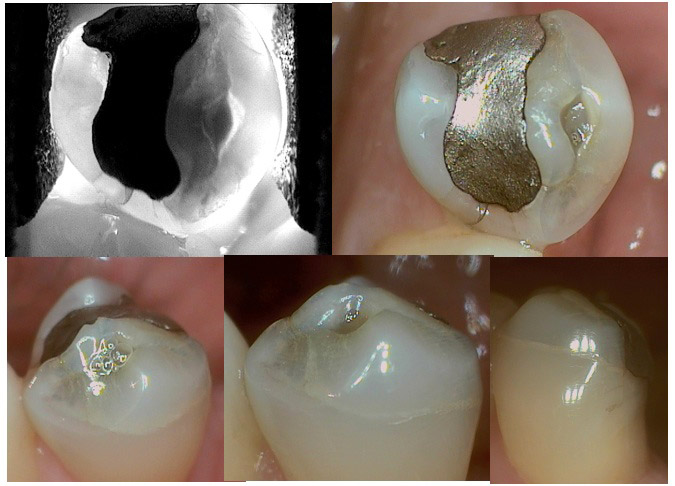Digital Doc | High Resolution Dental Intraoral Cameras, Hand held Xray
