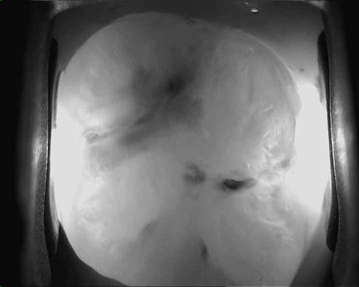 Digital Doc | High Resolution Dental Intraoral Cameras, Hand held Xray