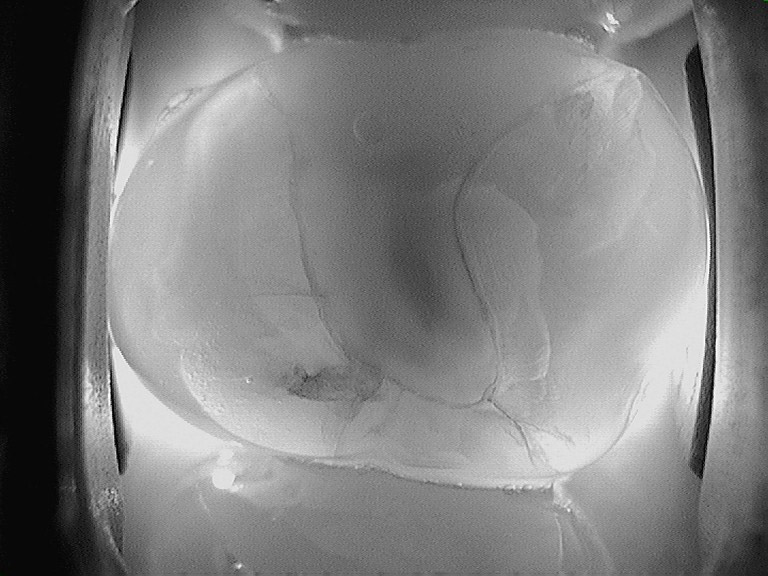 Digital Doc | High Resolution Dental Intraoral Cameras, Hand held Xray