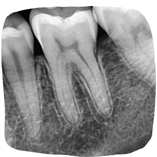 Dental Sensors | Digital Doc #1 INTRAORAL CAMERA FOR DENTISTS