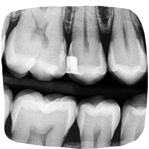 Dental Sensors | Digital Doc #1 INTRAORAL CAMERA FOR DENTISTS