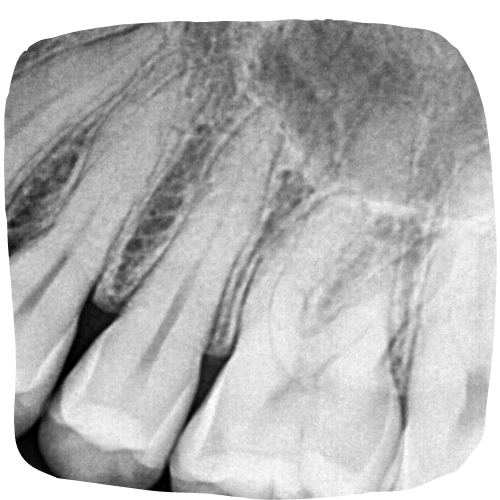 Dental Sensors | Digital Doc #1 INTRAORAL CAMERA FOR DENTISTS